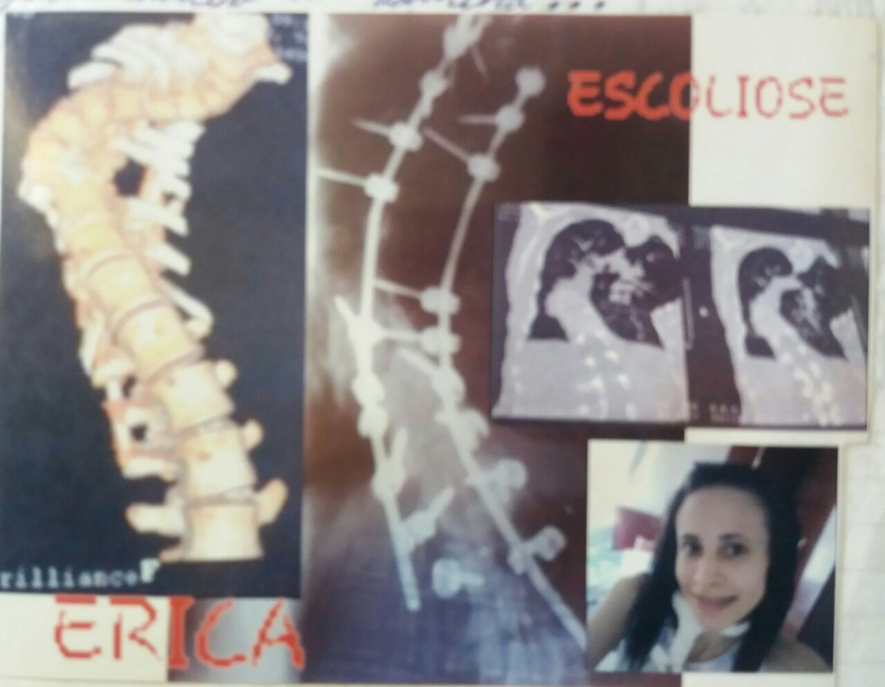 Erica Felix – Teresa Lodi